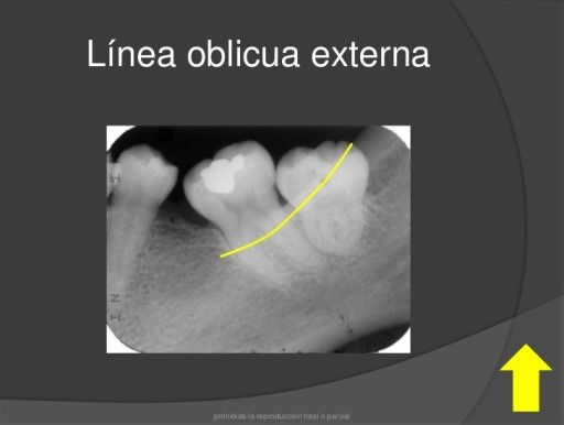 Linea Oblicua Externa