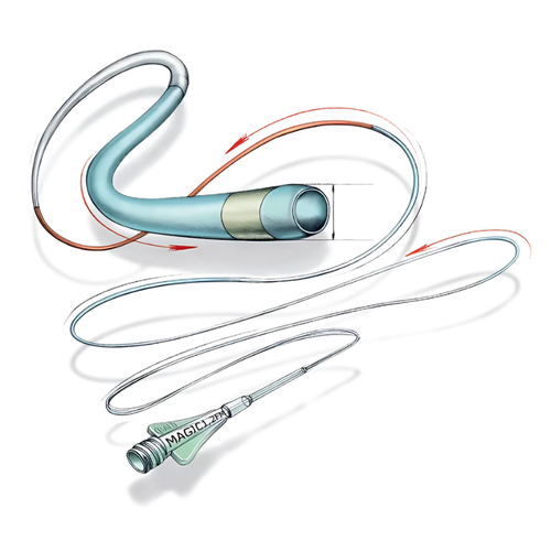 Magic — flow dependent microcatheter | Compass Medical