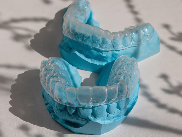 Clear Aligner Expansion | Masterpiece Smiles