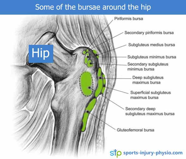 3 Interesting facts about Hip/Trochanteric Bursitis | Sports Injury Physio