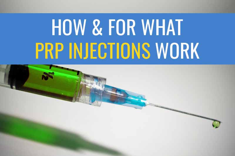 How PRP injections work and when they might be useful | Sports Injury ...