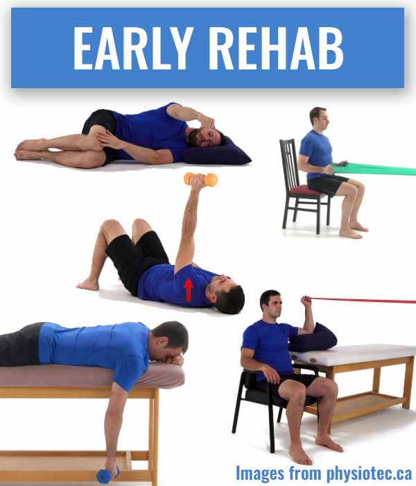 Conservative treatment for SLAP lesions | Sports Injury Physio