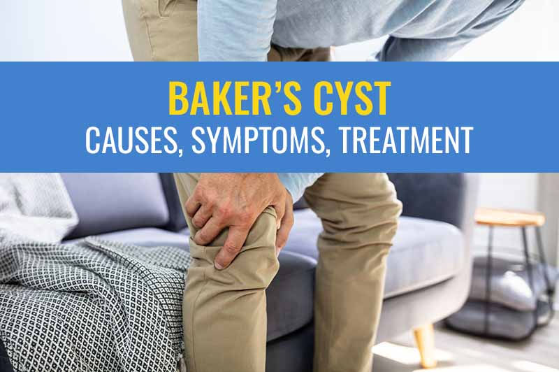 Baker’s cyst causes, symptoms, and treatment options (conservative vs ...
