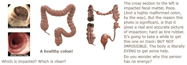 Colon Hydrotherapy Christchurch