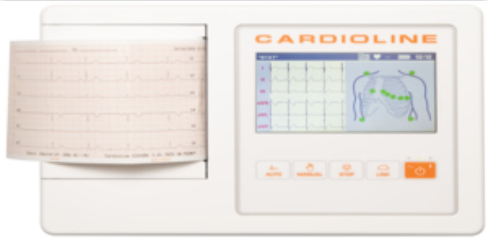 Cardioline ECG - How does ECG help us?