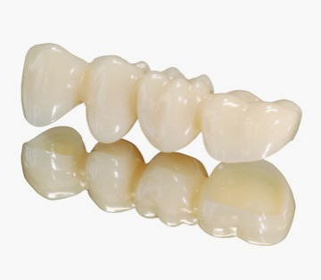PMMA Crown - Multi Layered | Designer Dental Arts
