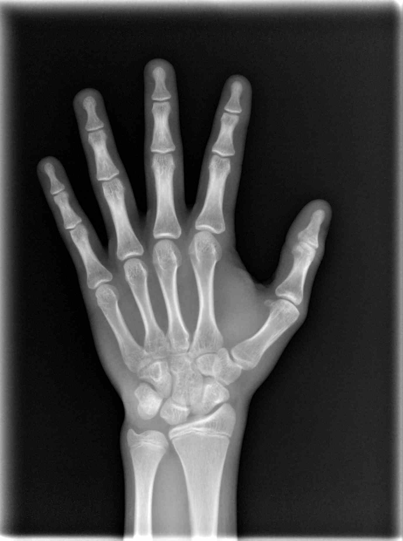 Radiografia De Mano Derecha | My XXX Hot Girl Radiografia De Mano Derecha | My XXX Hot Girl