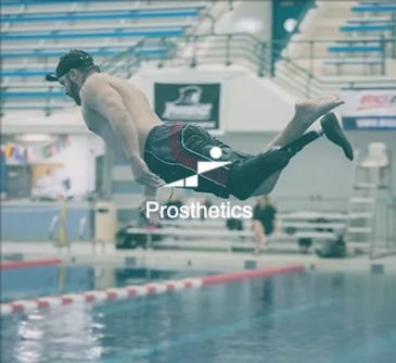 Prosthetics & Orthotics | Osseointegration Prosthetics | Eschen Labs