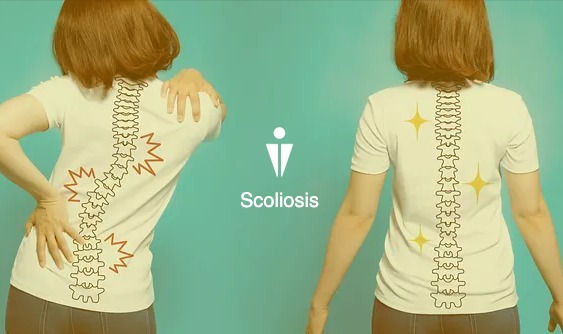 Prosthetics & Orthotics | Osseointegration Prosthetics | Eschen Labs