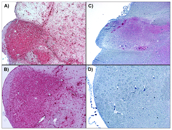 Antigen Retrieval in Brain Tissue