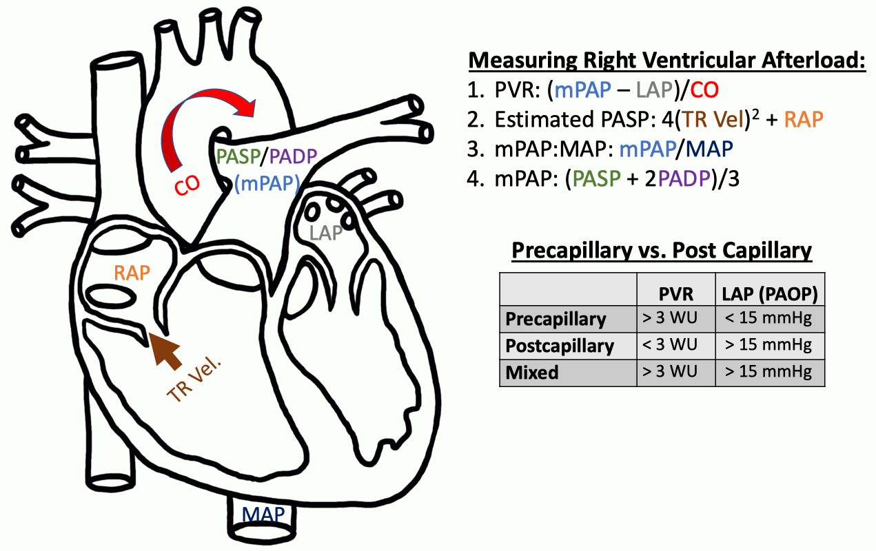 Right Heart Failure: Understanding the hemodynamics - Part 3: Afterload