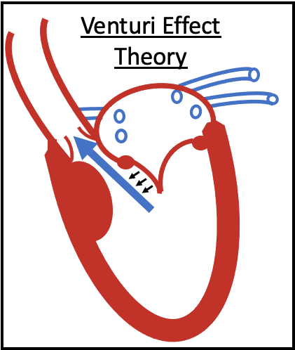 Left Ventricular Outflow Tract Obstruction (LVOTO) and SAM