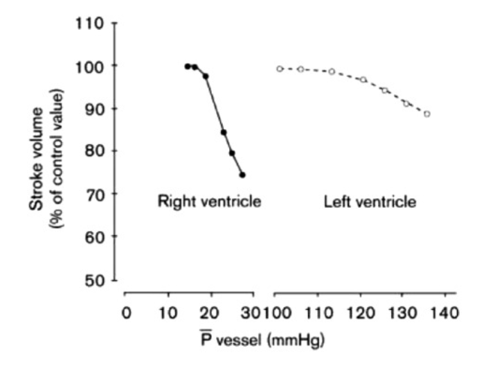 Right Heart Failure: Understanding the hemodynamics - Part 3: Afterload