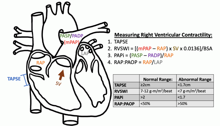 Right Heart Failure: Understanding the hemodynamics - Part 4: Treating ...