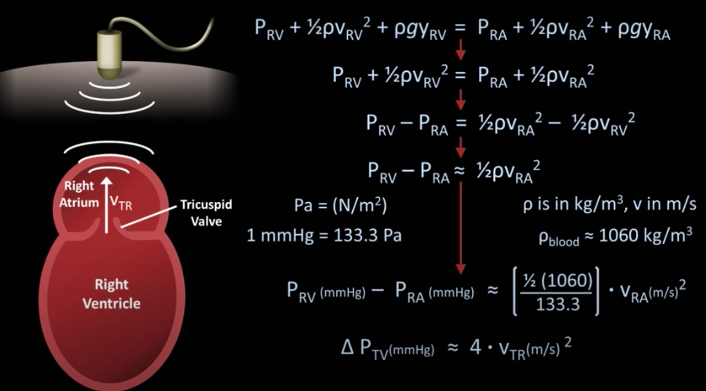 Right Heart Failure: Understanding the hemodynamics - Part 3: Afterload