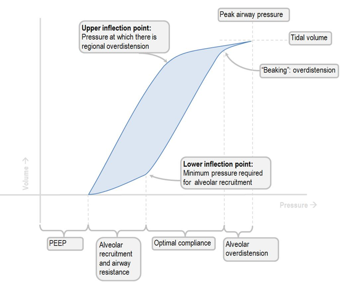 Transpulmonary Pressure: Time to individualize the ventilator.