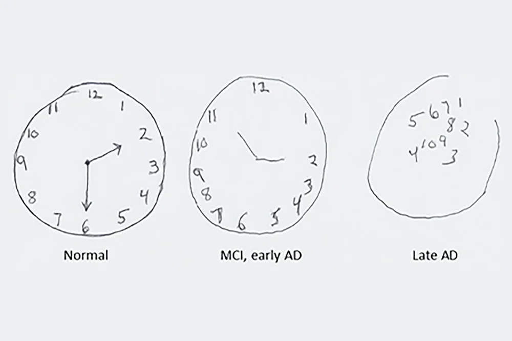 How drawing a clock can indicate whether you have memory loss disorders ...