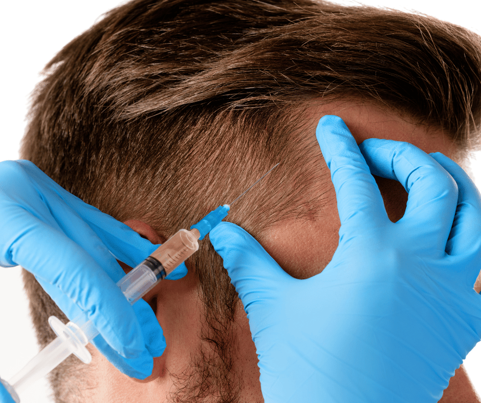 PRP Therapy for Hair Loss: How It Works & Benefits
