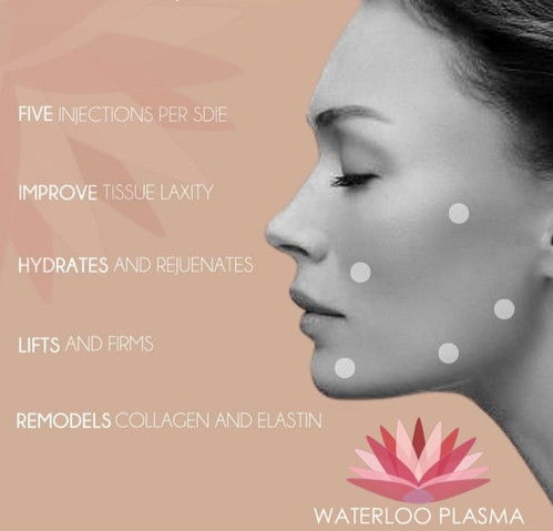 Hyaron 5 Point Mesotherapy Skin Boosting Treatment | Waterloo Plasma