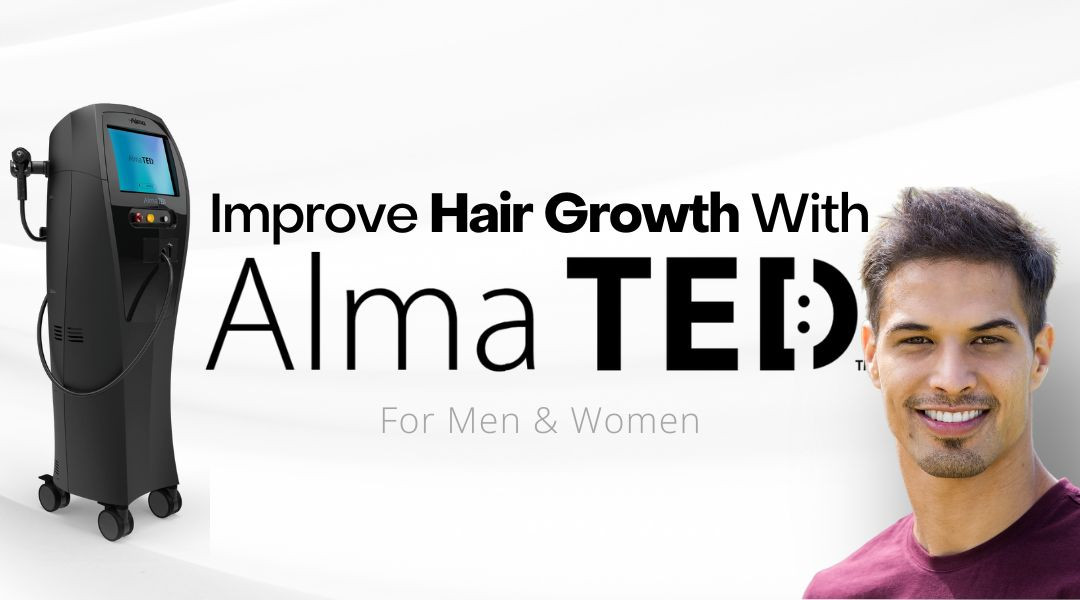 How Alma TED Can Improve Hair Growth: A New Solution for Hair Loss