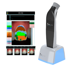 Cobra Digital Shade Scan | Dental Imaging Equipment | Video Dental