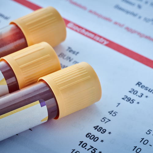 Hormonal Blood Test | KL, PJ | Esteliq Clinic