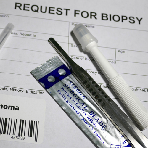 Histopathology, Biopsy Report | KL, PJ | Esteliq Clinic