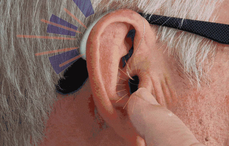Understanding Hearing Aid Feedback: Causes, Prevention, and Solutions
