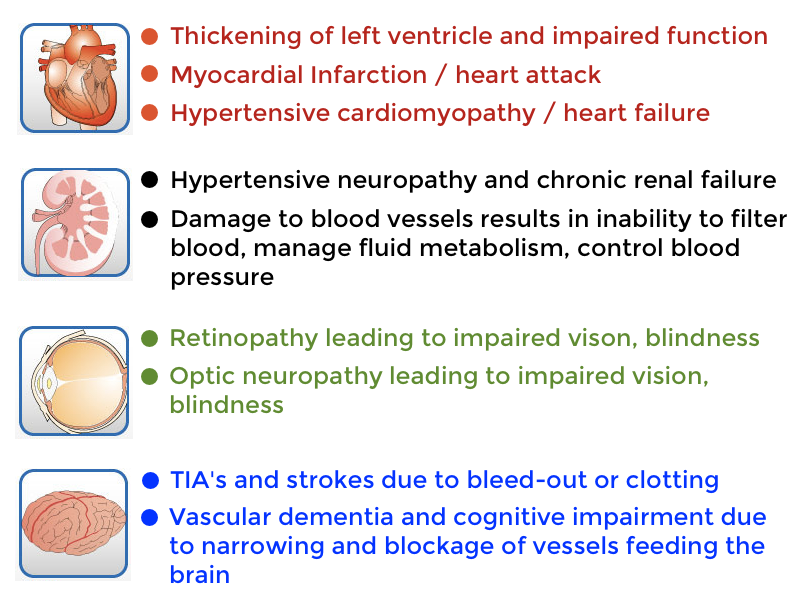 Hypertension