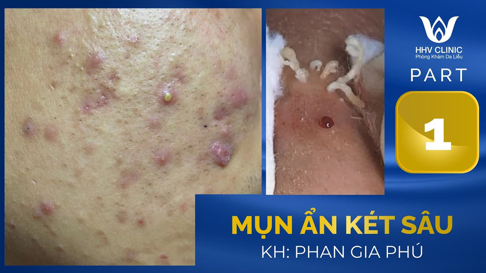 Now THIS is a video worthy of Hien Van Spa!! Finally!