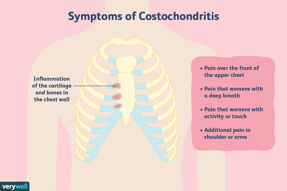 Chest Pain Possible Problems chest-pain-possible-problems