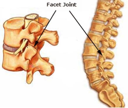 Understanding your back pain, and how chiropractic can help