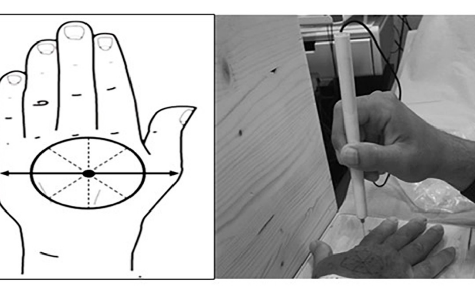 Reliability of upper limb pin-prick stimulation with electroencephalography