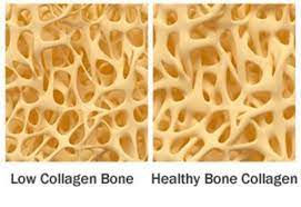 Collagen & Bone Health
