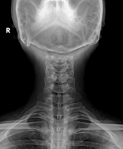 Rayos X de Columna Cervical (3 proyección) | UniRad