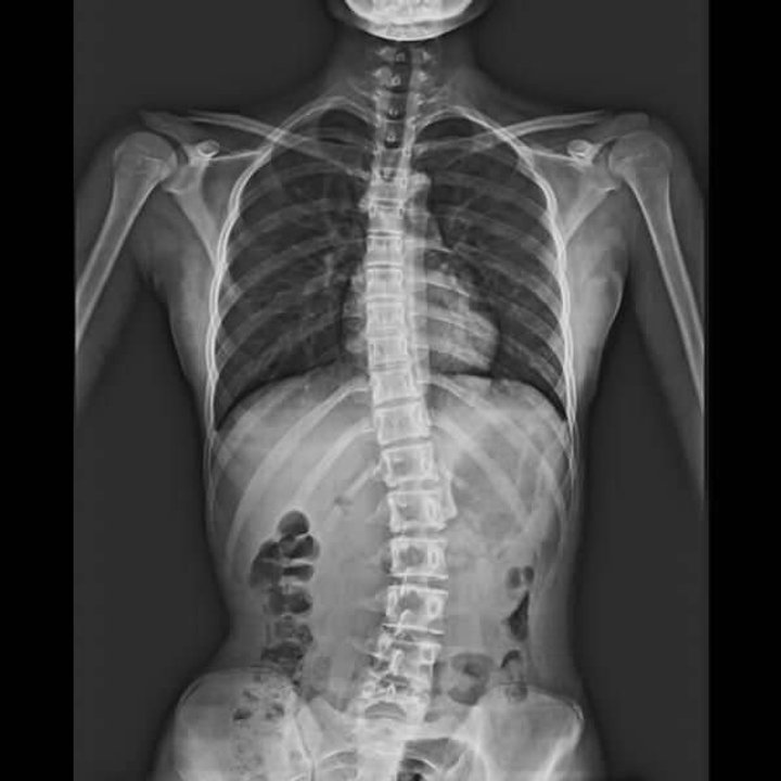 Anatomía De Rayos X
