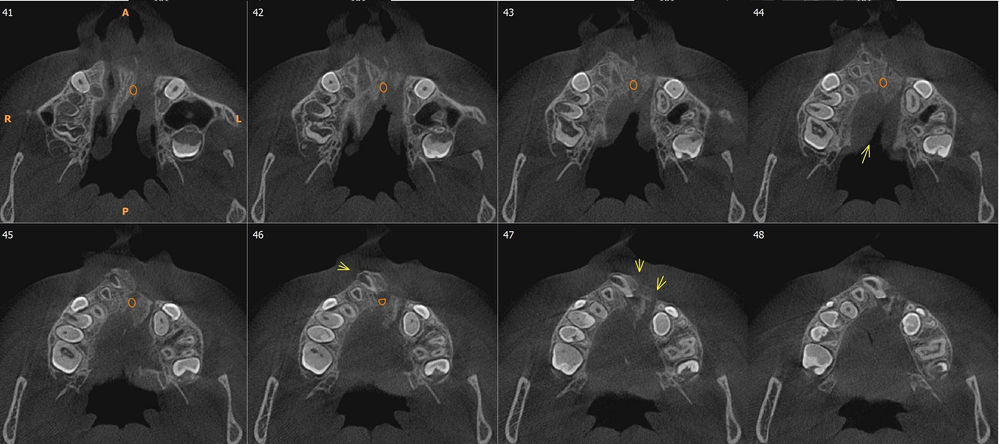 FOV (Field of visualization) and its relation to treatment requirements ...
