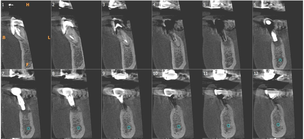 FOV (Field of visualization) and its relation to treatment requirements ...