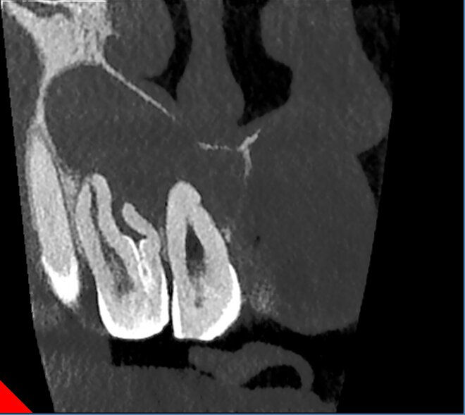 FOV (Field of visualization) and its relation to treatment requirements ...