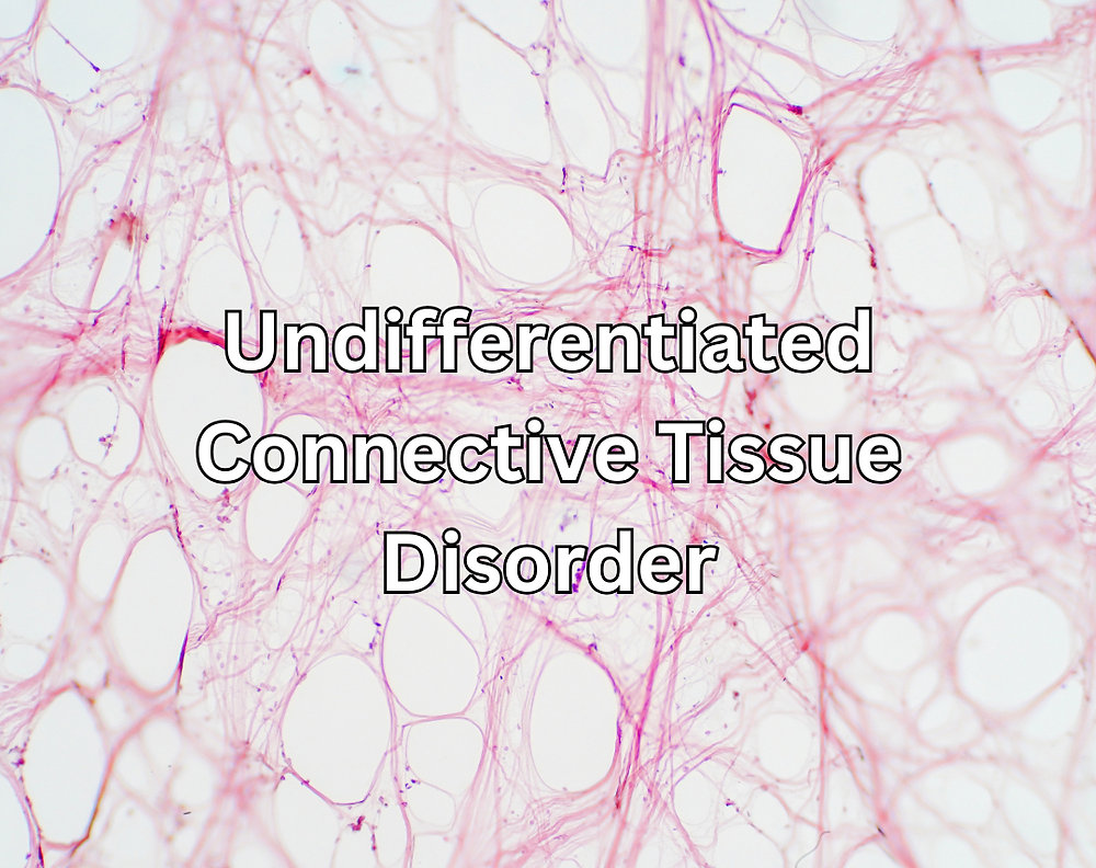 What Is UCTD? Undifferentiated Connective Tissue Disorder (UCTD)