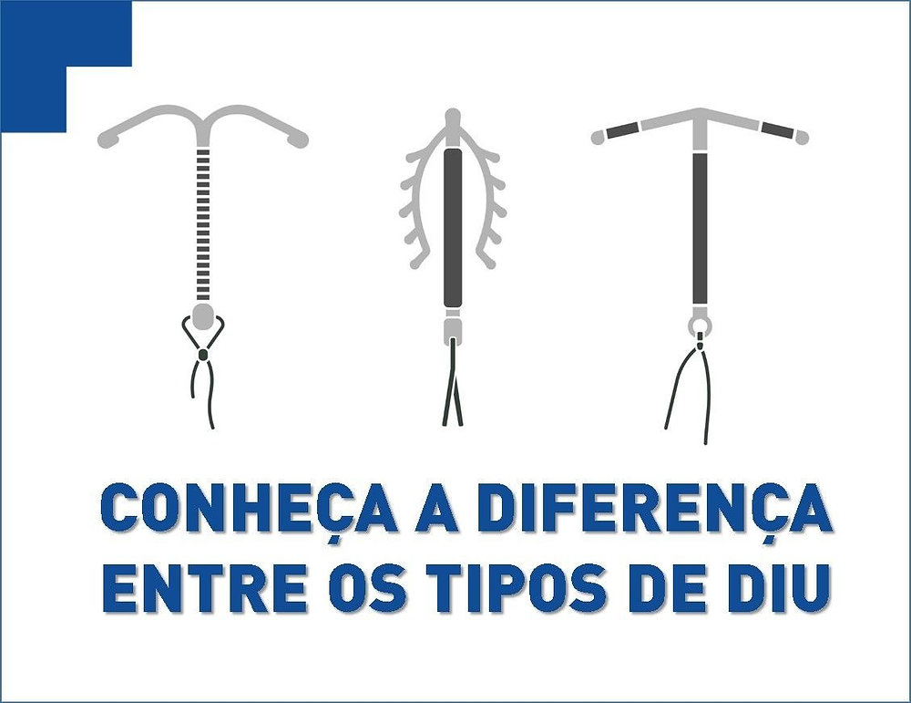 Quais as diferenças entre DIU hormonal e não hormonal?