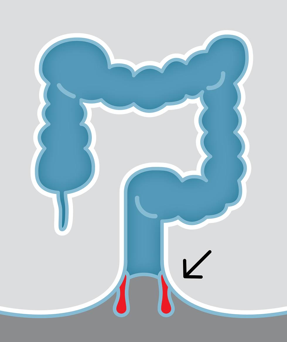 Gastroenterology Conditions - Gastroenterology Of The Rockies