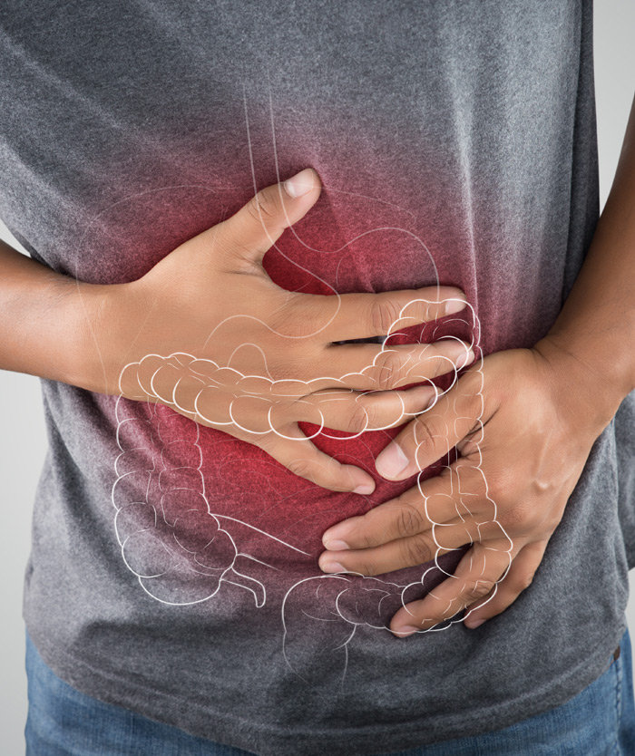 Colitis Treatment, Colitis Doctor - Gastroenterology Of The Rockies
