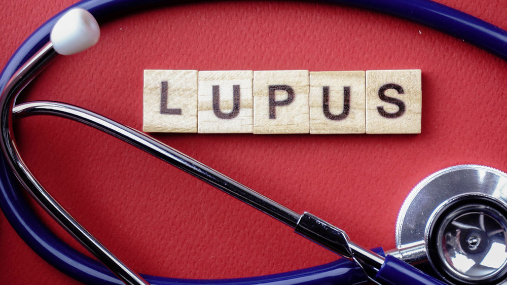How do we diagnose systemic lupus (SLE)?