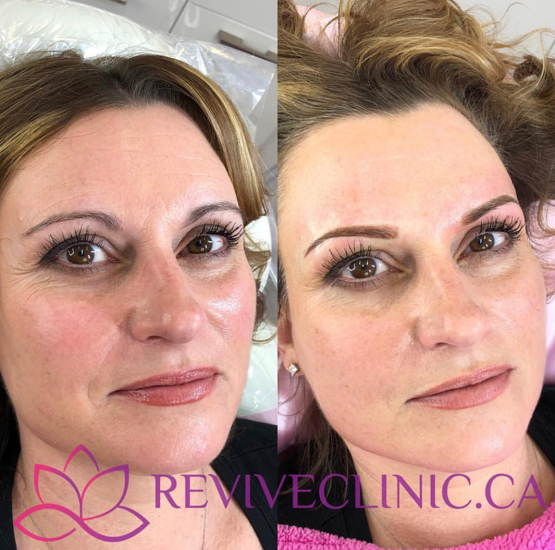 Full Face full-face