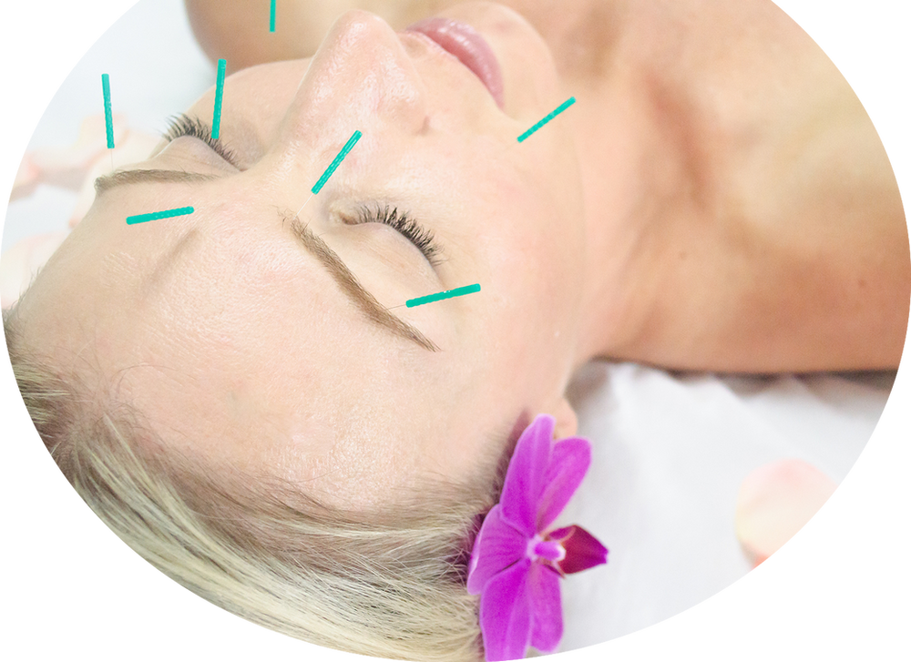 Facial Acupuncture Series