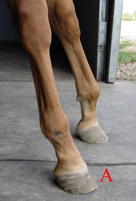 How to Construct and Apply a Shoe to Compliment a Superficial Flexor ...