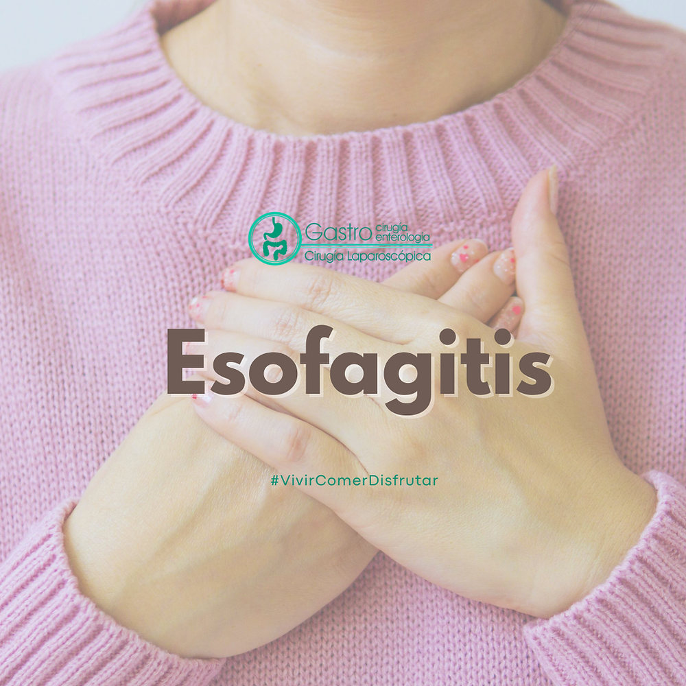 ¿Qué es la Esofagitis? Causas, Síntomas y Tratamiento