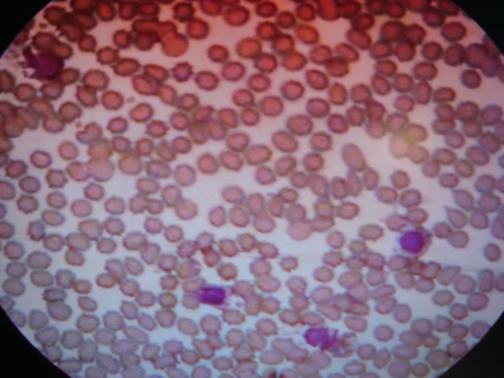 PRÁCTICA Nº4: TINCIÓN PANÓPTICO RÁPIDO