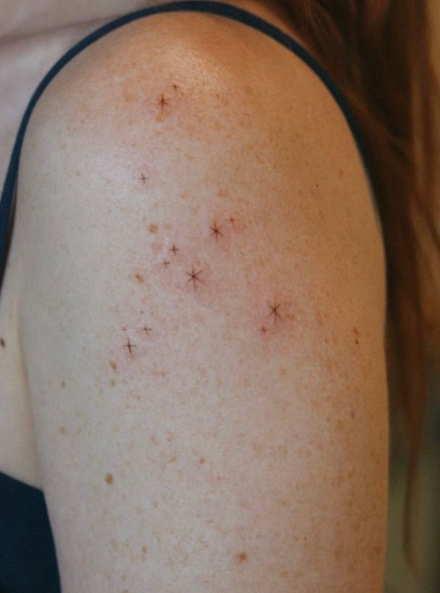 New Service - faux freckle tattoos 🌞